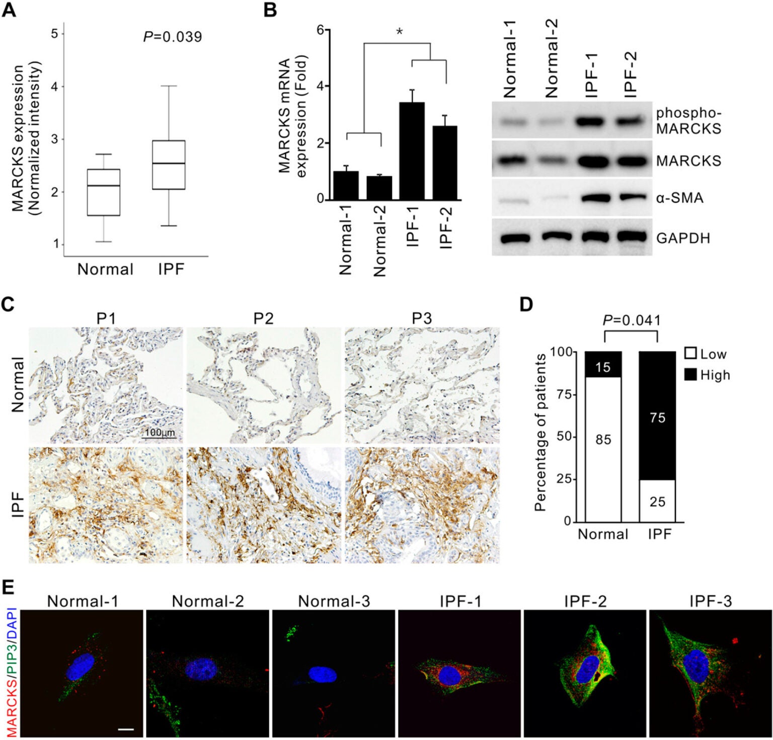 Tackling MARCKS-PIP3 Circuit Attenuates Fibroblast Activation and ...