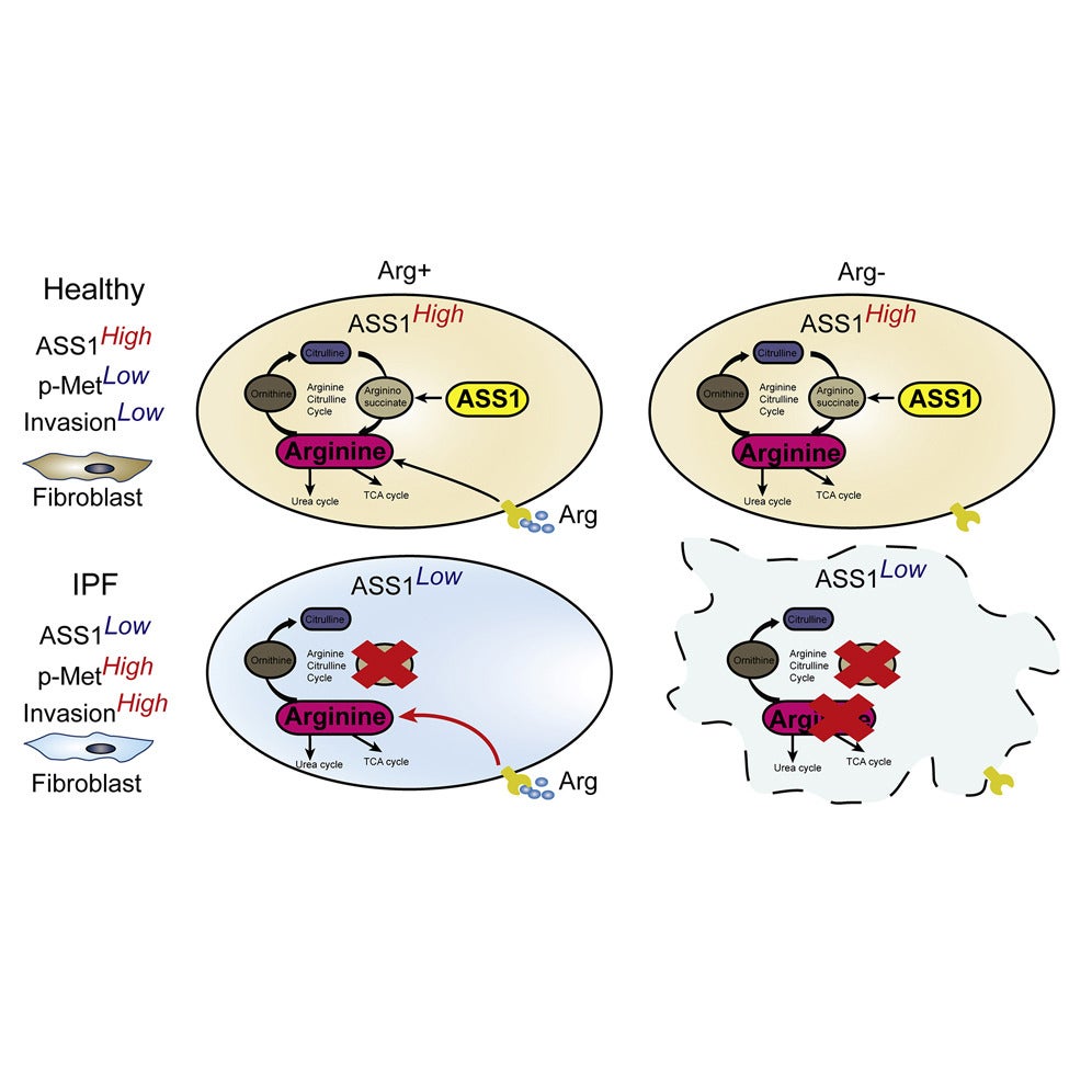 Therapeutic targeting of argininosuccinate synthase 1 (ASS1)-deficient ...